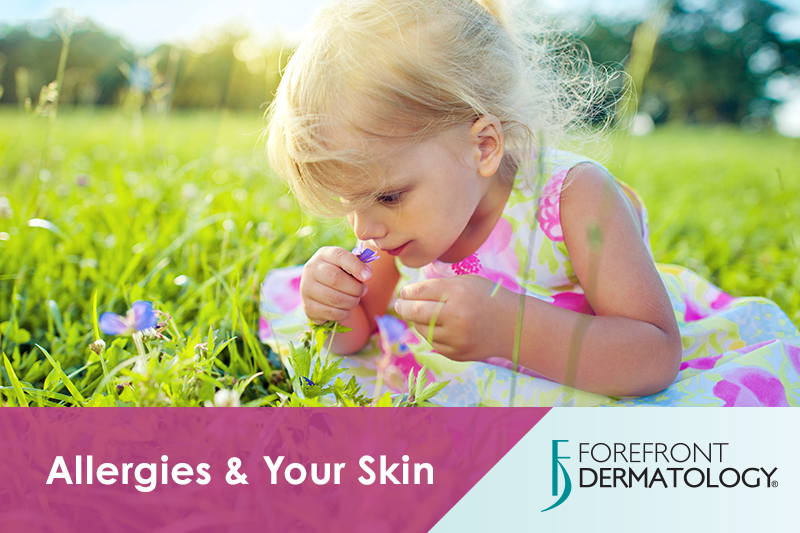 Allergies and Your Skin - Forefront Dermatology
