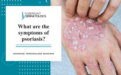 Acne Facts | Forefront Dermatology