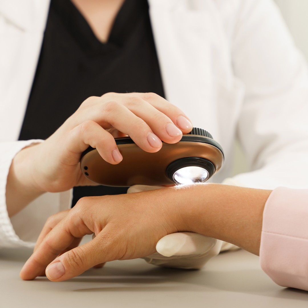 Skin Cancer Treatment Options - Forefront Dermatology